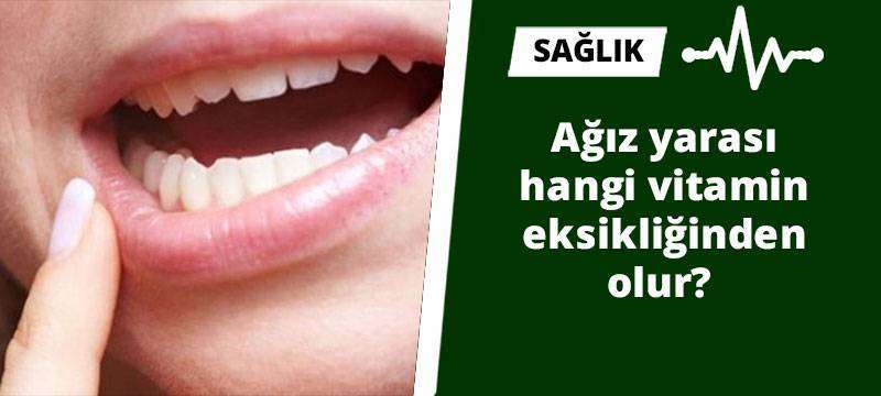 Ağız yarası hangi vitamin eksikliğinden olur? Aft bulaşıcı mı, krem ...